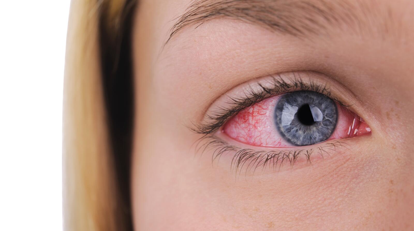 7 Things Bulimia Does to Your Body