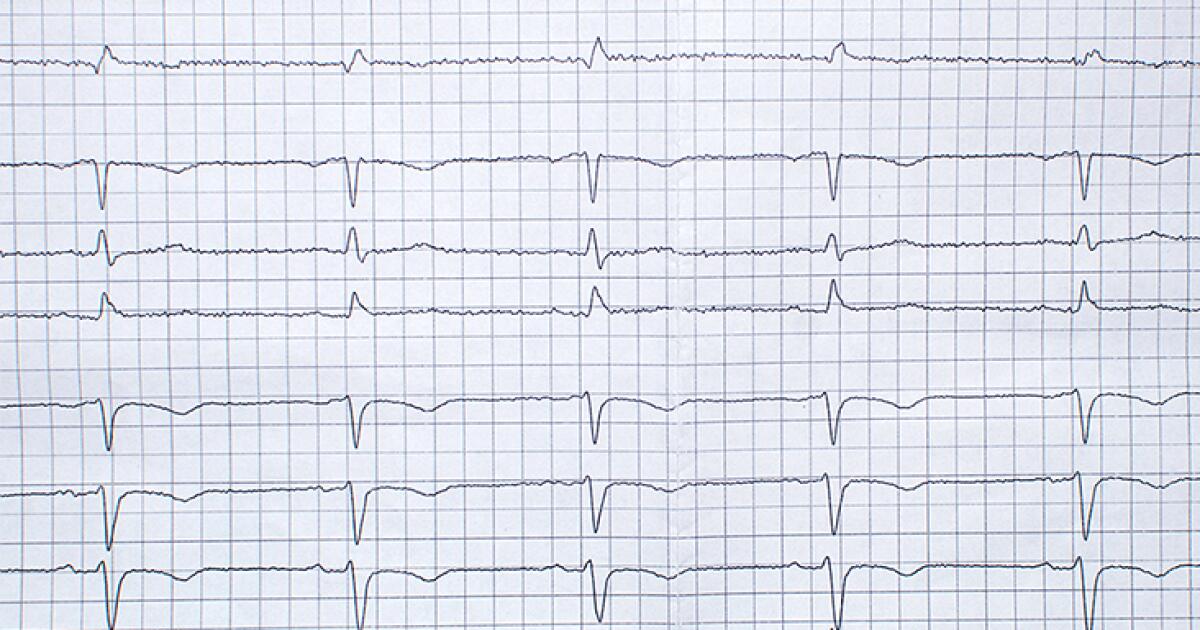 Systolic Heart Failure: Symptoms, Causes, and More