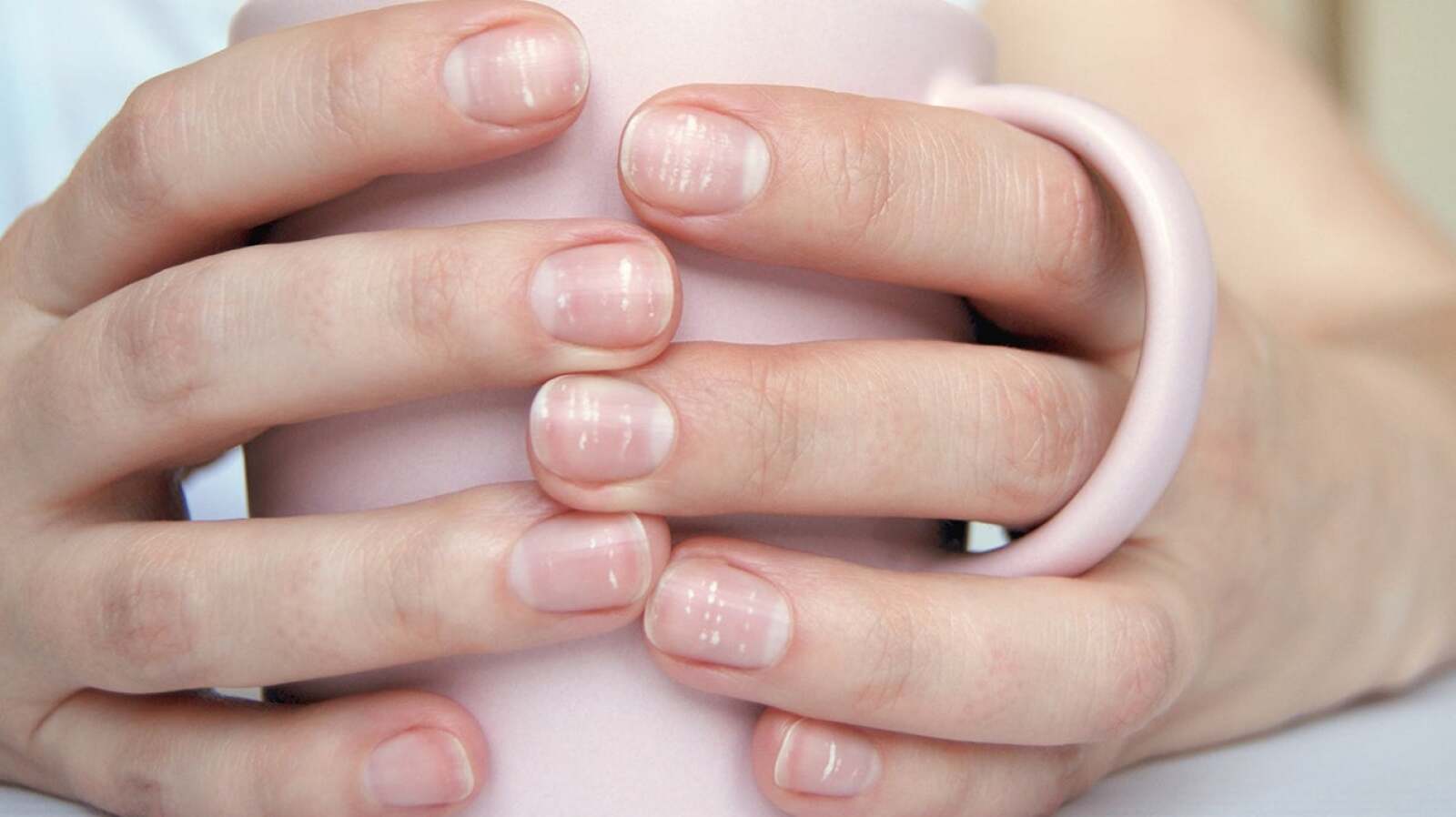 White Spots on Nails: Causes, Treatment, and More
