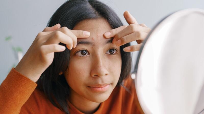 Blind Pimples: Symptoms, Causes, Treatments, and When to Seek Help