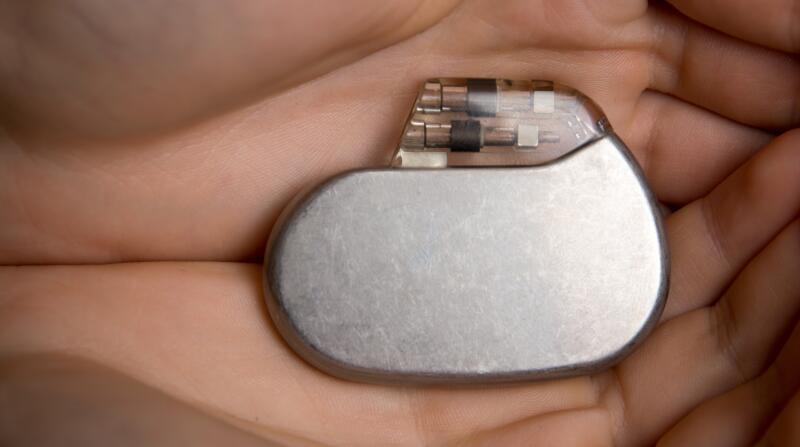 Pacemakers: 11 Things Cardiologists Want You to Know