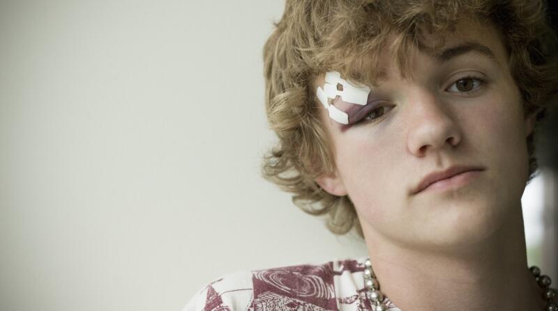 6 Common Fireworks-Related Injuries