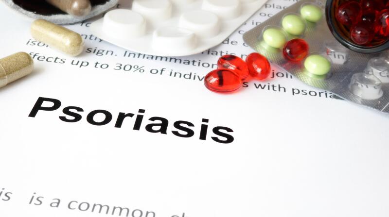 4 Reasons to Try a New Psoriasis Medication