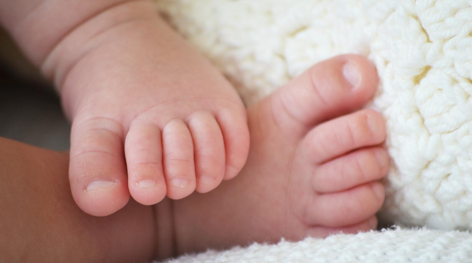 Top 6 Reasons for a Colostomy