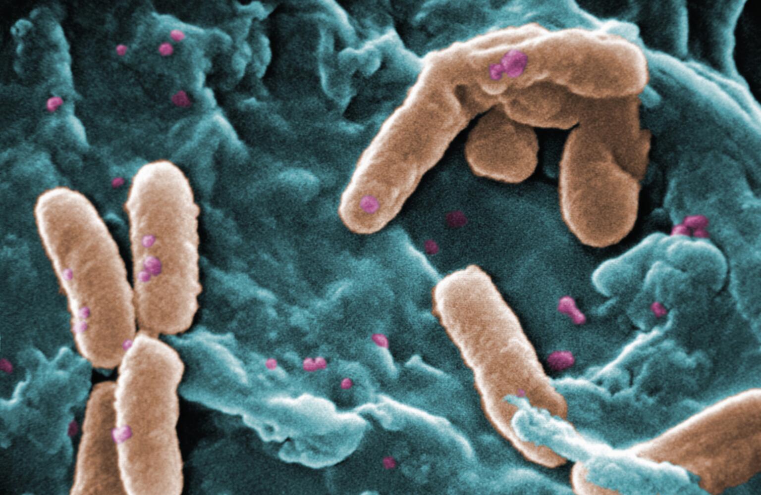 Pseudomonas Infection: Symptoms & Treatment | P. aeruginosa & P ...