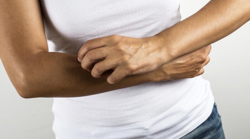 Severe Eczema Signs | Severe Eczema