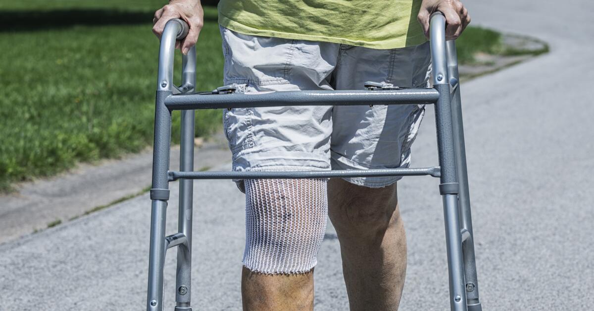 Stiffness After Knee Replacement: Causes & Coping Tips