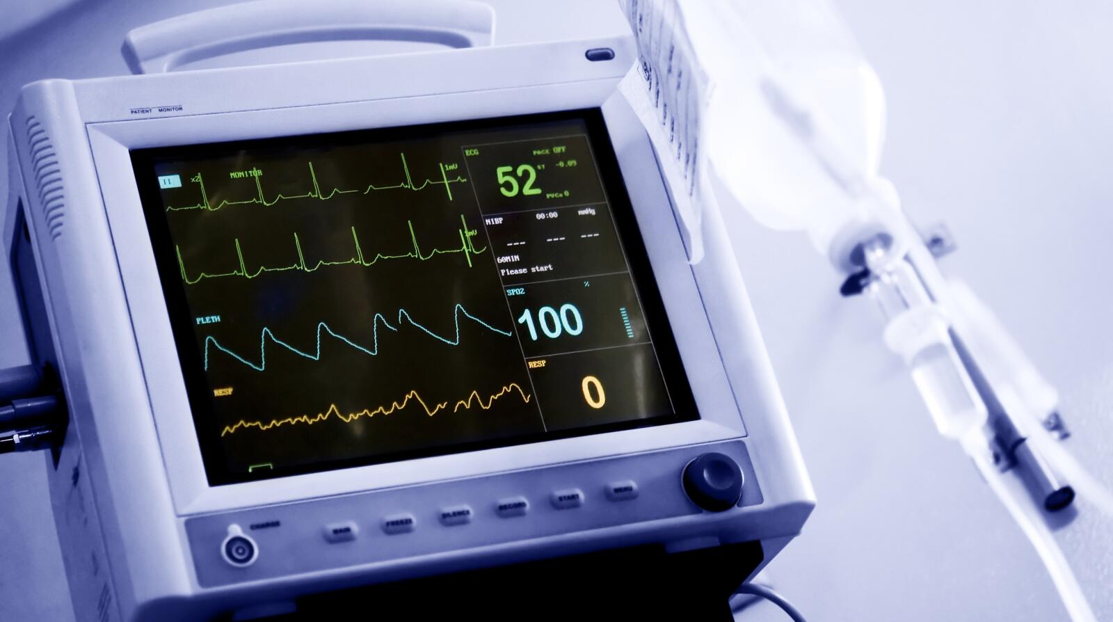 8 Things to Know About Cardioversion