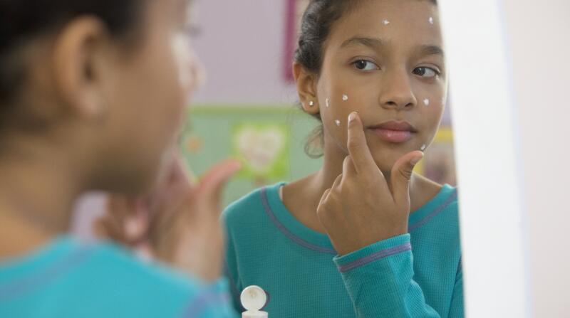 Acne Information | 7 Things You May Not Know About Acne