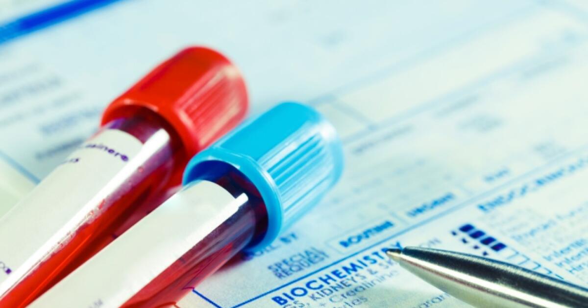 Urosepsis - Symptoms, Causes, Treatments