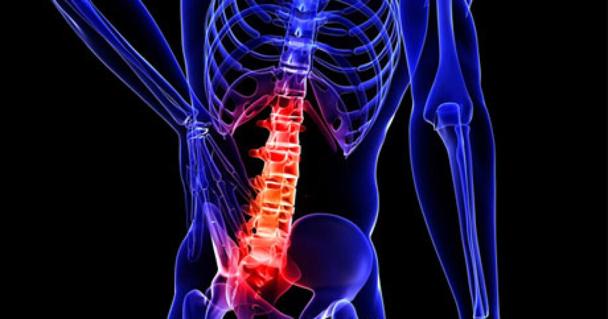 Discogram (Spine X-ray): Why It's Done, Risks, What to Expect