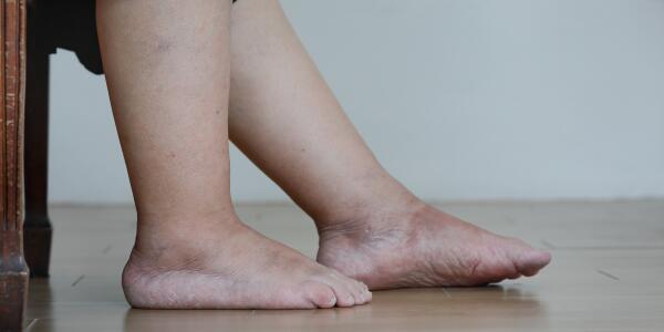 8 Symptoms of Heart Disease | Heart Disease Early Warning Signs