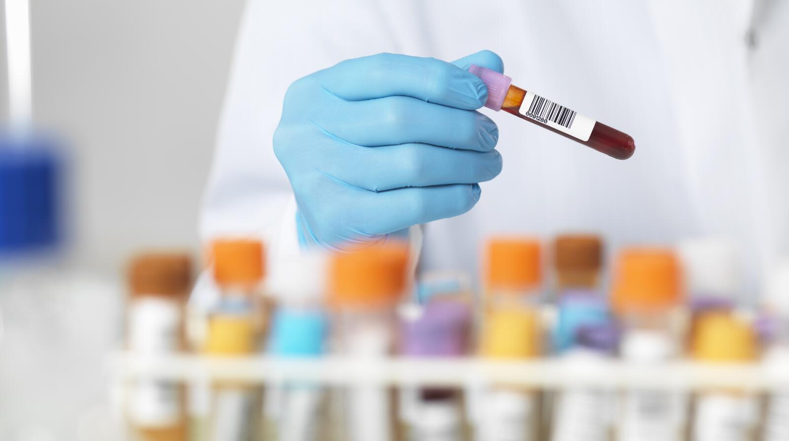 10 Things You Should Know About Carotid Artery Surgery