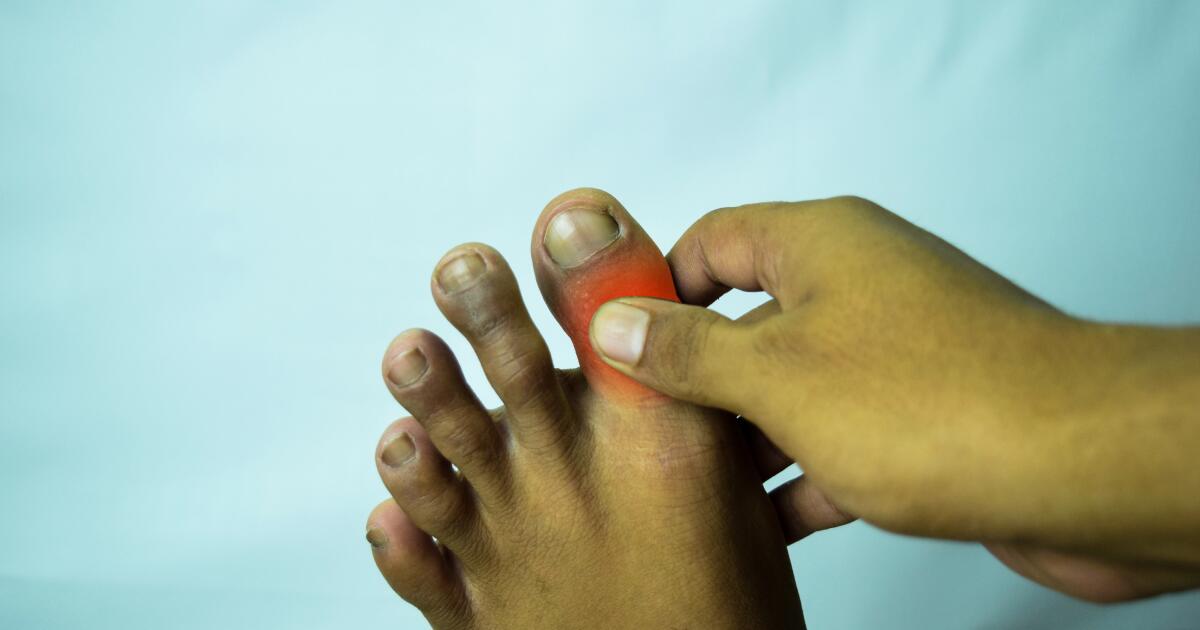 7 Common Causes of Big Toe Pain