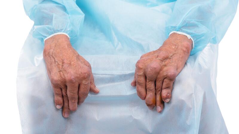 Polyarthritis — Symptoms, Causes, Diagnosis, Treatments