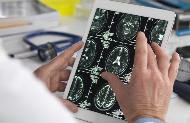 White Spots on a Brain MRI: What It Means