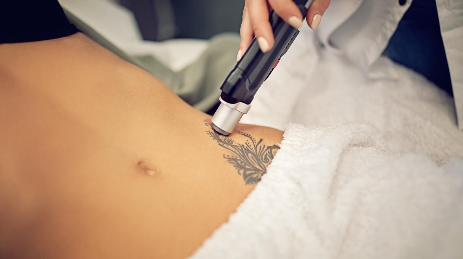 Types of Laser Skin Treatments & What They Do