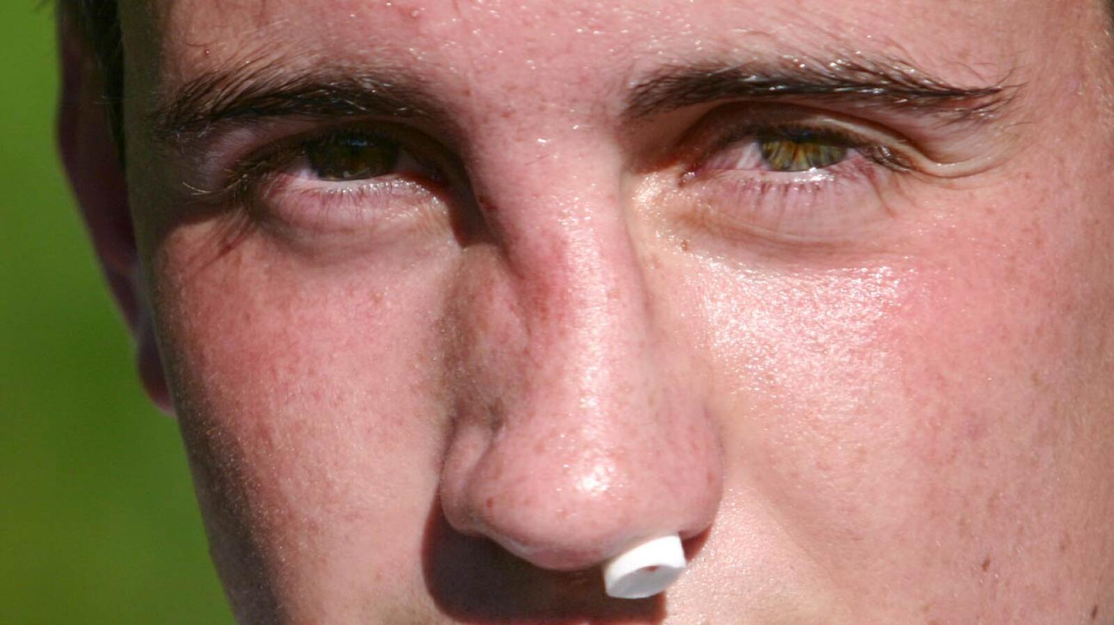 Face Swelling: Causes and More