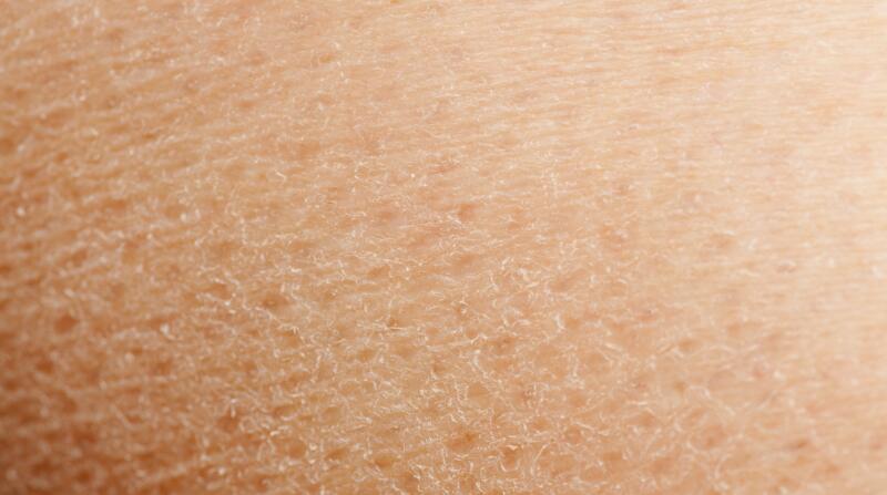 9 Signs of Sensitive Skin