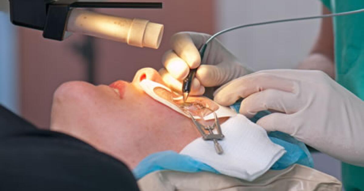 LASIK Eye Surgery: Procedure Details, What to Expect