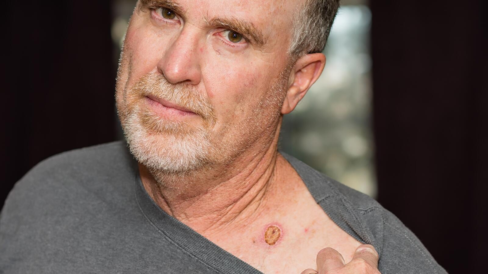 Treating Hypopigmentation: Causes, Remedies, and More