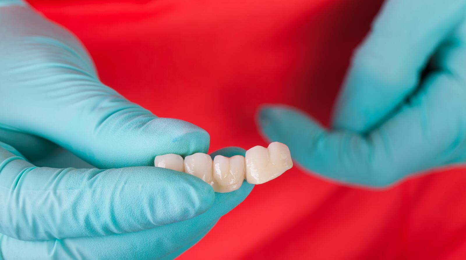 Artificial Teeth: 6 Things to Know | Artificial Teeth Options