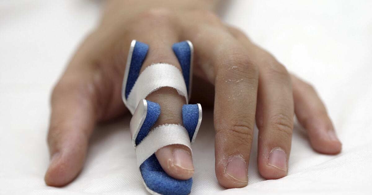 Broken Finger - Symptoms, Causes, Treatments