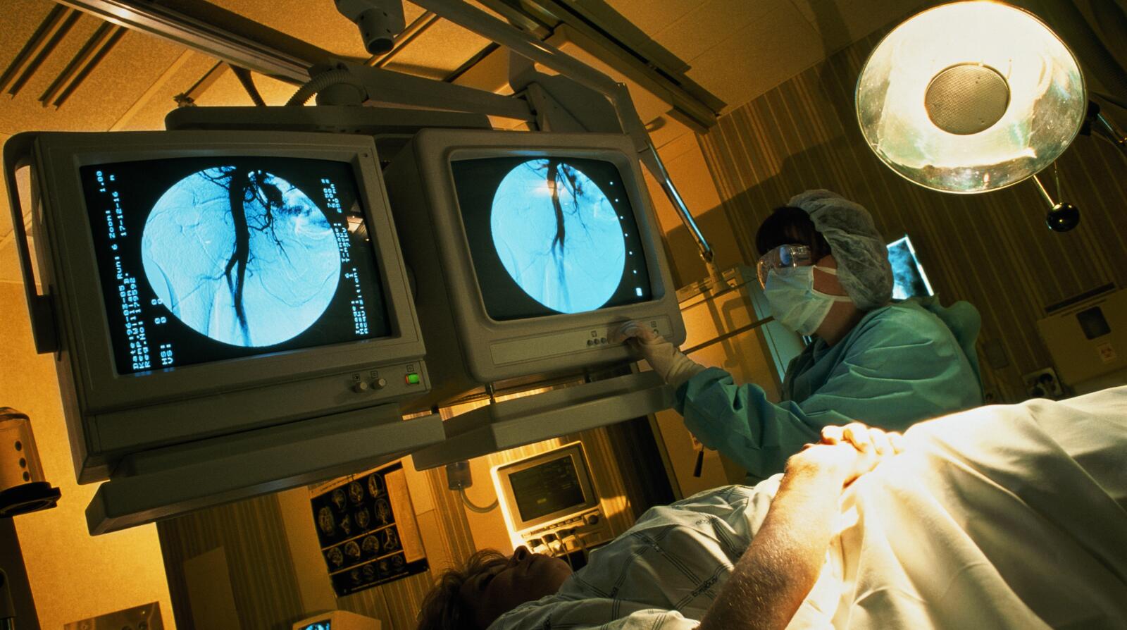 Cardiac Catheterization: 9 Things Doctors Want You to Know