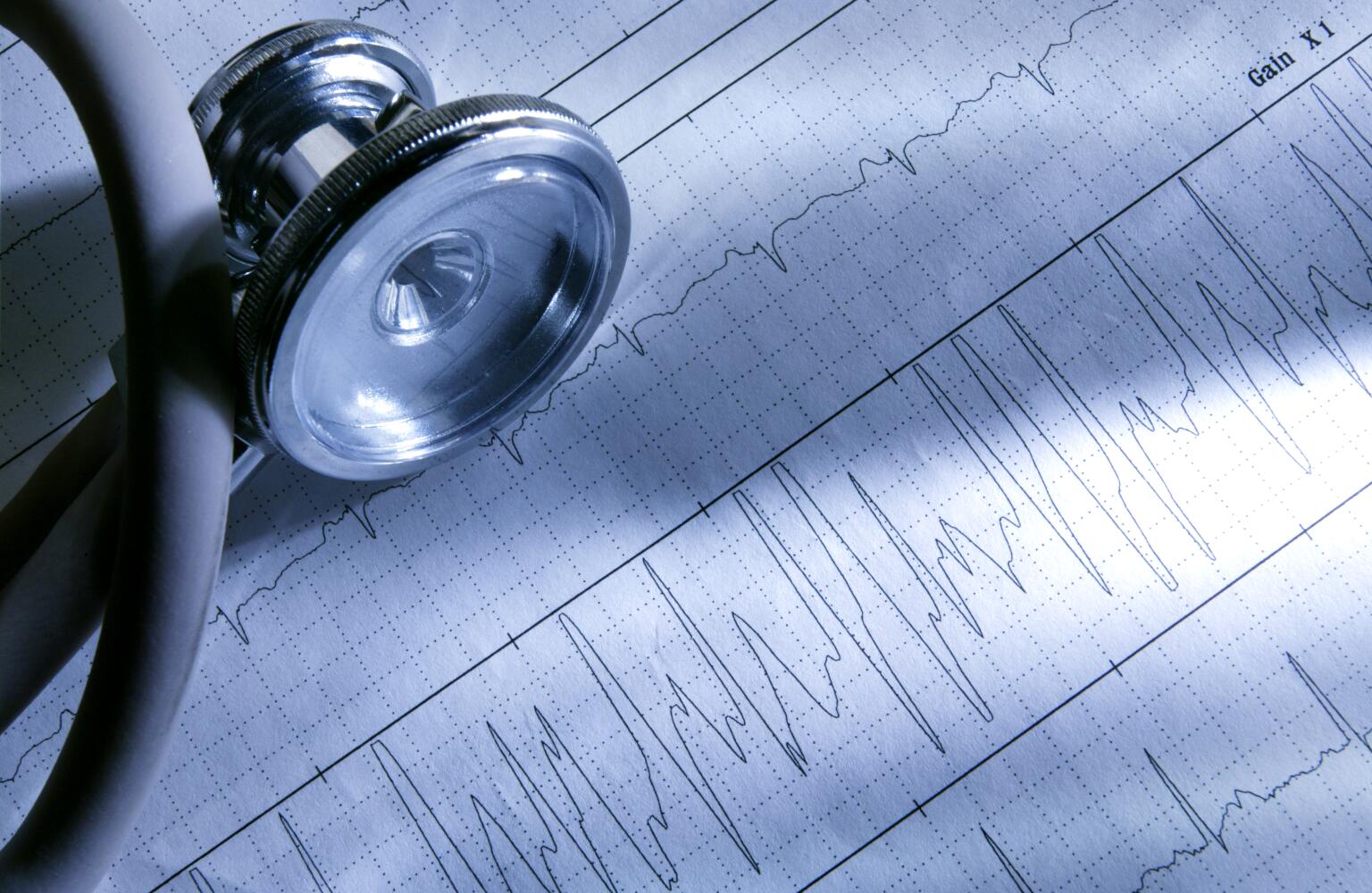 Why Your Doctor Might Order an EKG