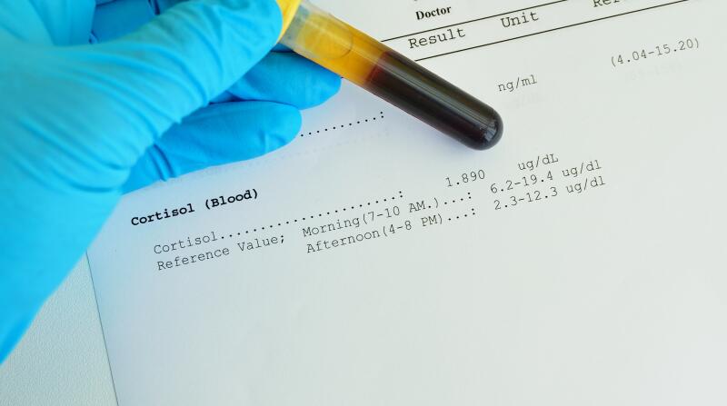 10 Things to Know About Psoriatic Arthritis