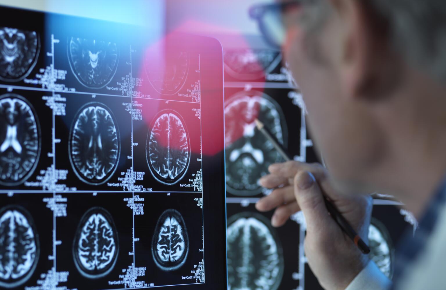 What Does the Parietal Lobe Do? | Parietal Lobe Function & Location