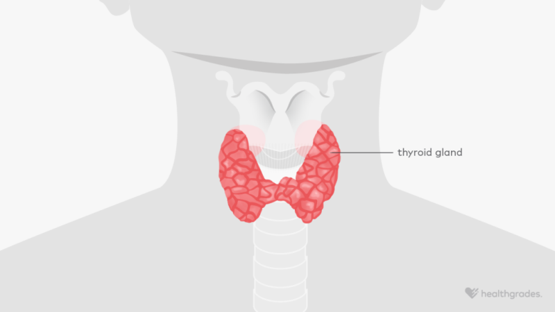 Hyperthyroidism vs. Hypothyroidism: How to Tell the Difference Hyperthyroidism vs. Hypothyroidism: How to Tell the Difference