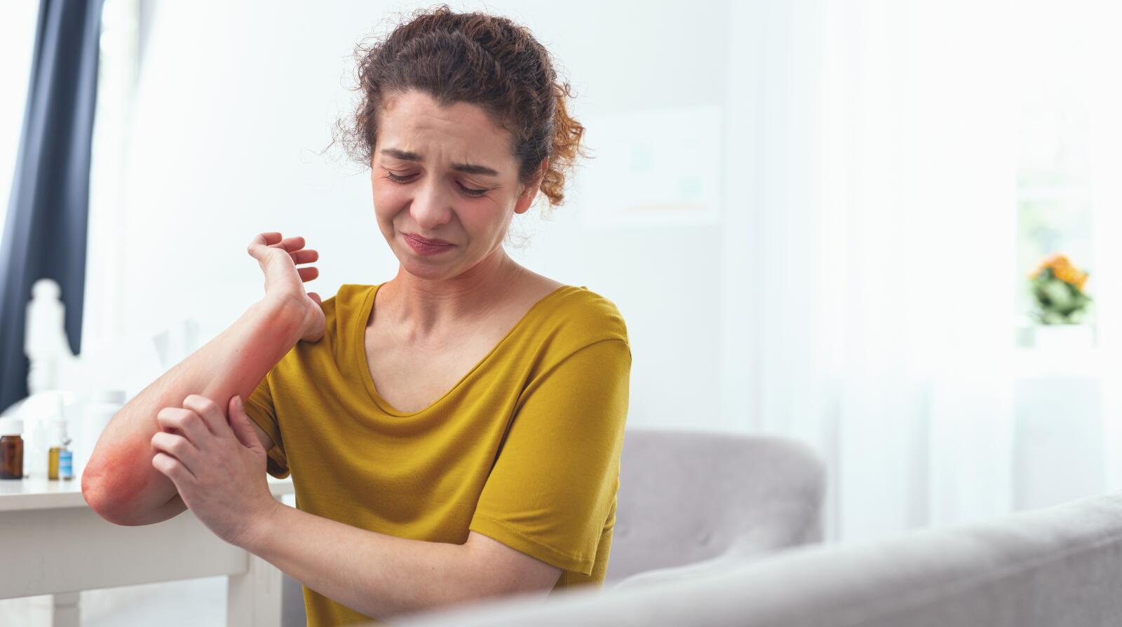 10 Things to Know About Scabies | Skin Mites